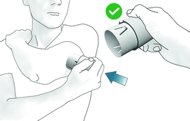 Applying Your Sensor